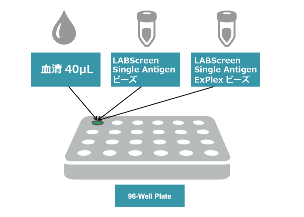 LABScreen Single Antigen ExPlex | 製品情報 | ベリタス